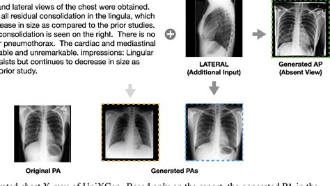 Figure From Unified Chest X Ray And Radiology Report Generation Model