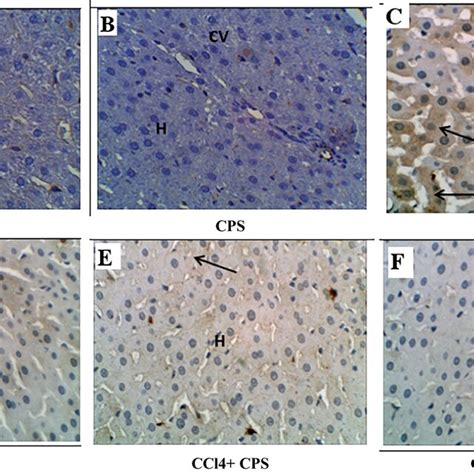 Immunohistochemical Staining In Liver Sections Different Experimental