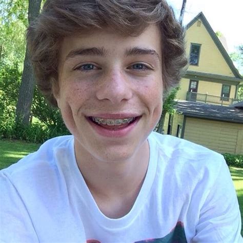 Omg He S So Handsome Different Types Of Braces Guys With Braces Adult