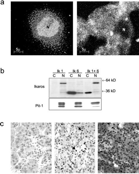 Localization Of Ik1 And Ik6 In Pituitary Cells A Immunofluorescence