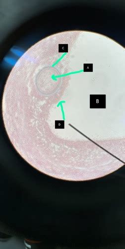 Lab Exam Urinary Male And Female Reproductive System Gametogenesis