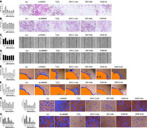 Hmgb1 Influenced Angiogenic Properties Via Different Redox States