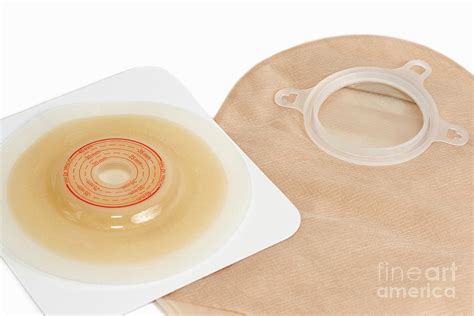 Ostomy Bag And Wafer Photograph By Science Photo Library Pixels Merch