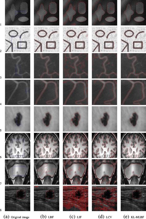 Comparison Of The Segmentation Results With Medical Images Download Scientific Diagram