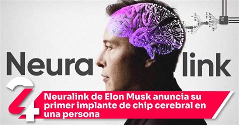 Neuralink De Elon Musk Anuncia Su Primer Implante De Chip Cerebral En