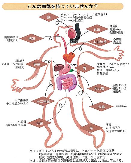アルコール依存症 精神疾患 京都市こころの健康増進センター
