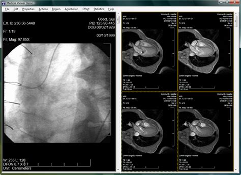 Leadtools Pacs Imaging Sdk