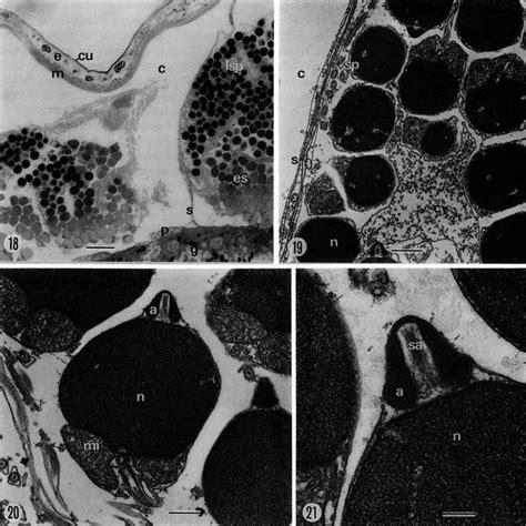 Light Micrograph Of A Longitudinal Section 1 Pm Thick Through The Download Scientific Diagram