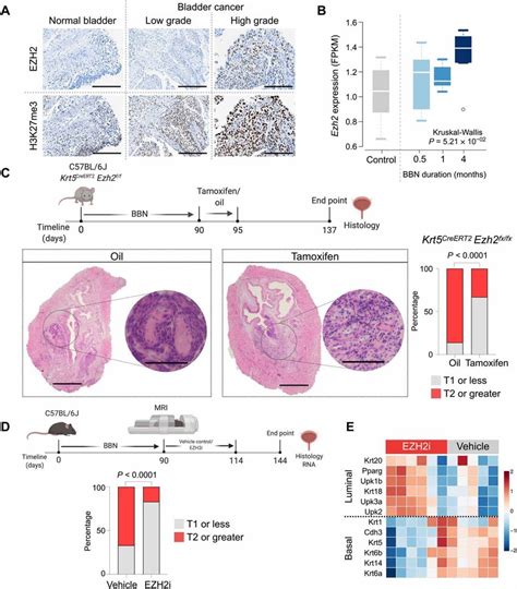 Ezh2 And Its Catalytic Function Promote Higher Bca Stages A Download Scientific Diagram