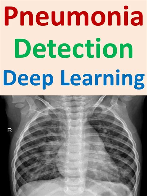 Pneumonia Detection From Chest X Ray With Flask App Deep Learning Project Mahesh Huddar