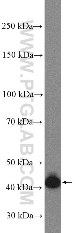 Ets1 Antibody 12118 1 Ap Proteintech