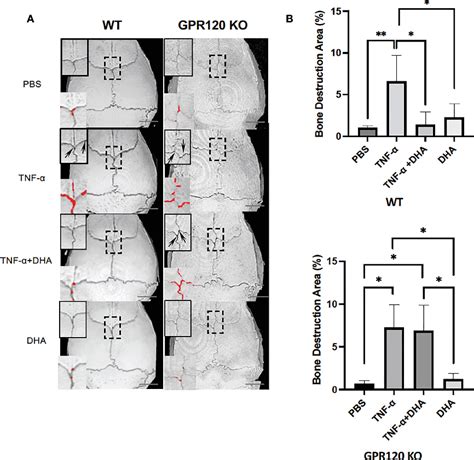 Figure 2 From Docosahexaenoic Acid Inhibits Tnf α Induced Osteoclast