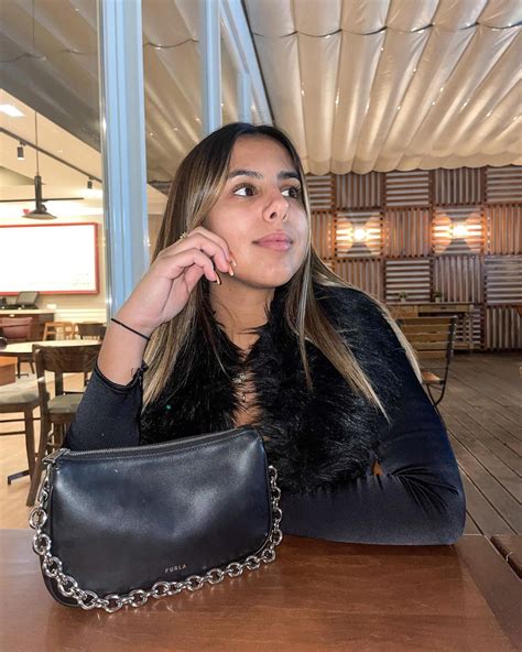 Joana Albuquerque faz procedimento estético ao rosto e mostra antes e