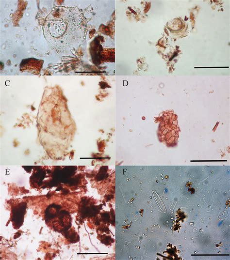 A Centropyxis Aculeata B Difflugia Urceolata C Difflugia Download Scientific Diagram