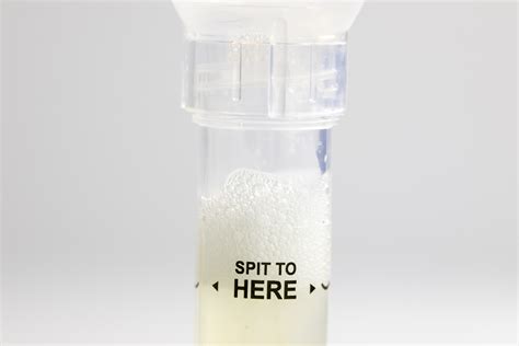 Sensitive And Consistent Sars Cov 2 Detection Via Saliva Samples Inside Precision Medicine