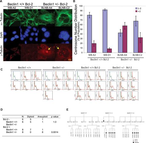 Autophagy Suppresses Tumor Progression By Limiting Chromosomal Instability