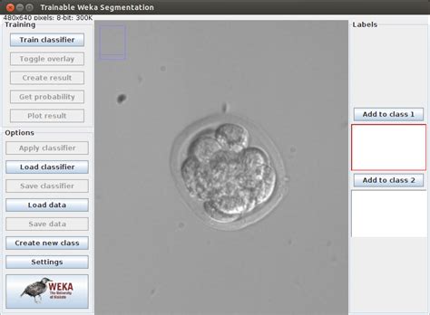 trainable weka segmentation how to install new classifiers