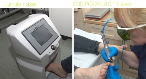 Advice For After Laser Fungal Treatment