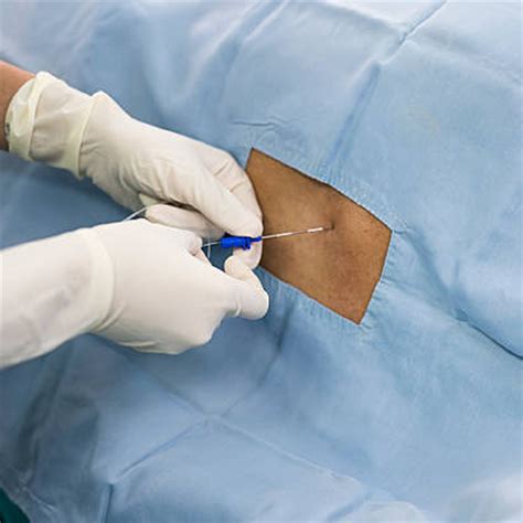 China Ultrasound Peripheral Nerve Block Needle Stainless Steel