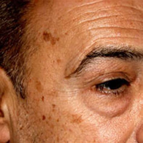 Wholistic Dermatology Health And Beauty Solutions Julia T Hunter Md