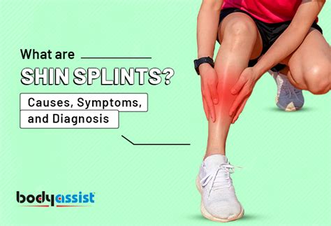 What Are Shin Splints Causes Symptoms And Diagnosis Bodyassist