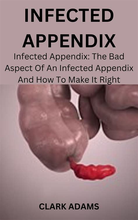 Infected Appendix