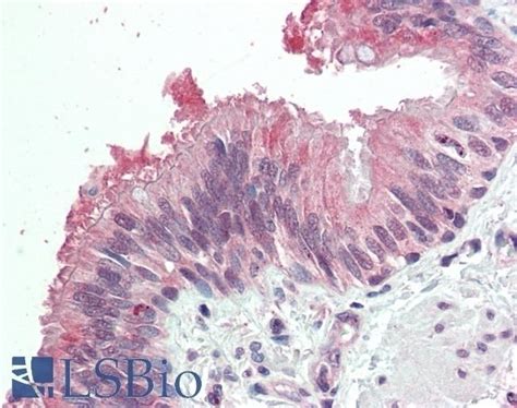 Ikzf1 Antibody Cat No 42 782 Prosci