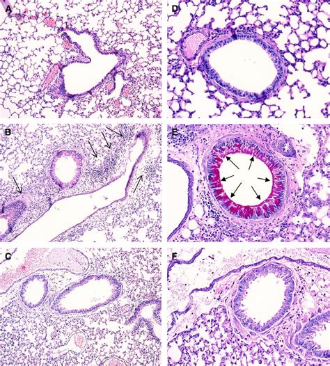 Airway Inflammation And Goblet Cell Metaplasia In Download