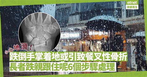 小心地滑！天雨路滑易跌倒，手掌撑地可能造成餐叉性骨折！長者跌親6個處理步驟 都市痛症 痛症解碼 健康好人生 Etnet 經濟通