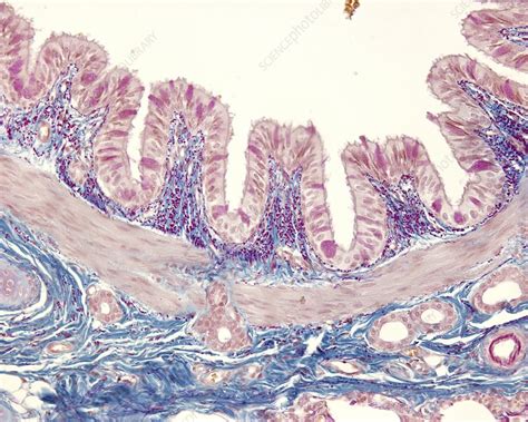 Bronchus Wall Light Micrograph Stock Image C0386287 Science Photo Library