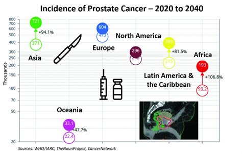 Prostate Cancer After Surgery