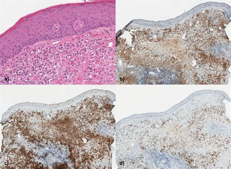 Histological And Immunohistochemical Examination A Medium Sized And