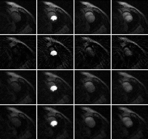 Figure 2 From Iterative Versus Non Iterative Image Reconstruction