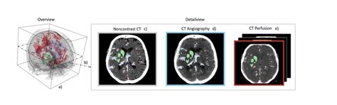 Overview And Detail View Of Multi Modal Brain Lesion Imaging Overview Download Scientific