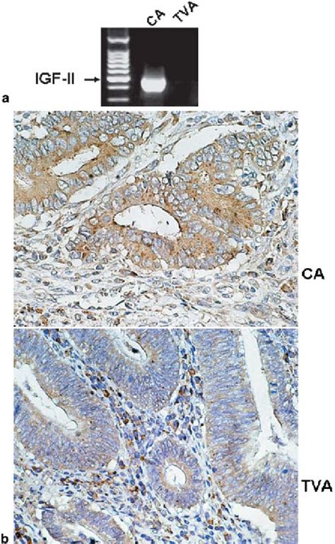 A Reverse Transcriptase Polymerase Chain Reaction Rt Pcr Analysis Of Download Scientific