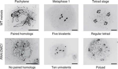 Meiosis In Wild Type Wt Above And Rnaidmc1 Transformants Belowin Download Scientific
