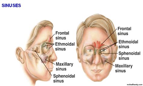 Maxillary Sinus Disease Pptx د وفاء Muhadharaty