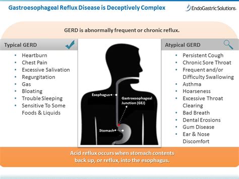 Gerd Chronic Acid Reflux Symptoms Causes Diagnosis Treatment Hot Sex
