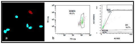Evaluation Of Sperm Dna Fragmentation Using Two Different Methods Tunel Via Fluorescence
