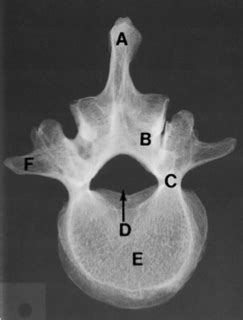 Lumbar Labeling Flashcards Quizlet