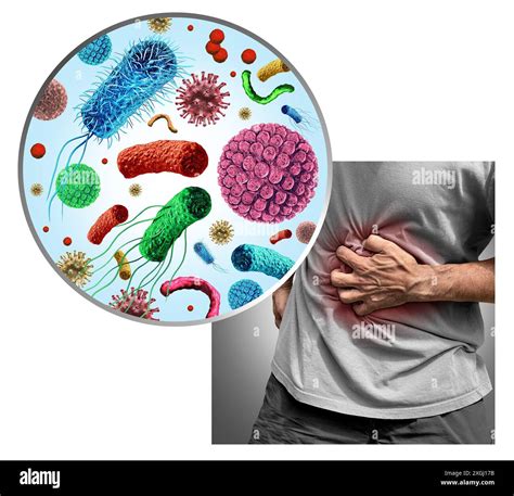 Viral Gastroenteritis Gastroenteritis When Travelling