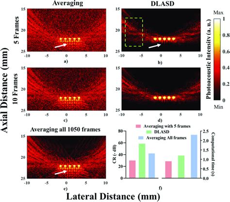 Reconstructed Images Via The Different Signal De Noising Methods A