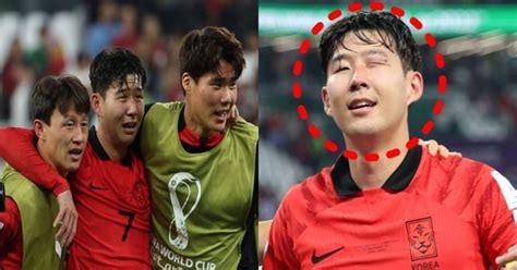이 상태로 뛴거야손흥민 경기 종료 후 공개된 얼굴 상태에 모두 눈믈흘렸다