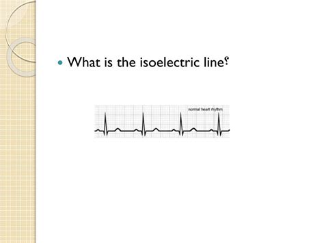 Ppt Ecg Powerpoint Presentation Free Download Id6925472