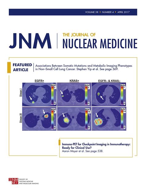 Metabolic Imaging Of Glutamine In Cancer Journal Of Nuclear Medicine