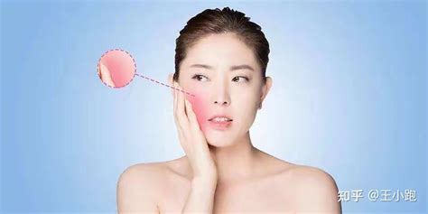 哪些后天原因会造成角质层薄呢？ 知乎