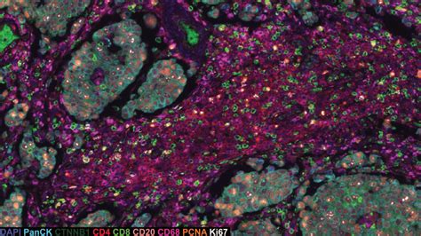 Industry Case Scilifelab Spatial Proteomics Key In Enhancing Advanced