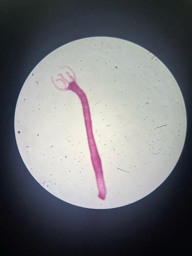 Lab 4 Invertebrates Flashcards Quizlet