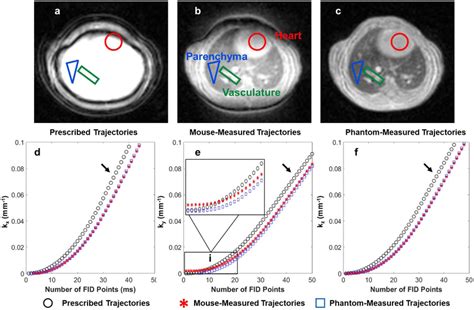 Impact Of Proper Trajectory Corrections On Reconstructed Images A C