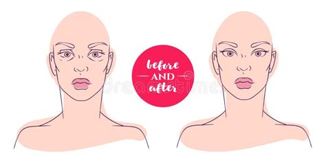 Portrait Of A Woman Before And After With Cosmetic Defects Stock Vector Illustration Of